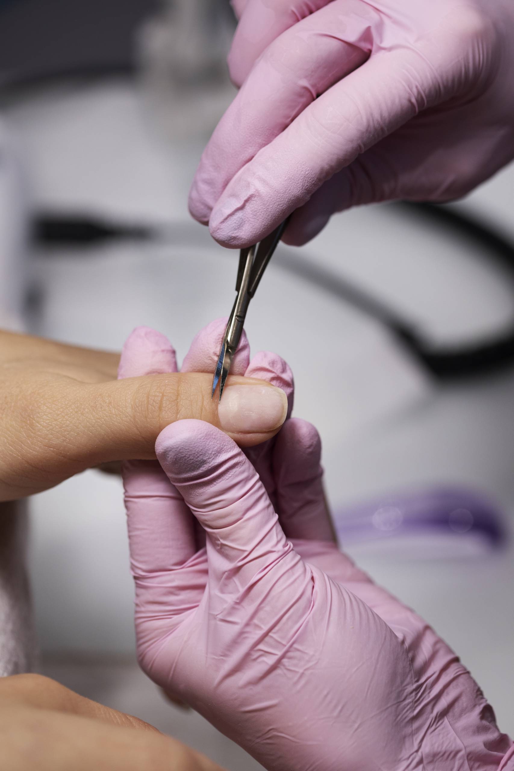 Best Nail Treatments From Infection Clinics in Kerala- Dr.Skin Clinics