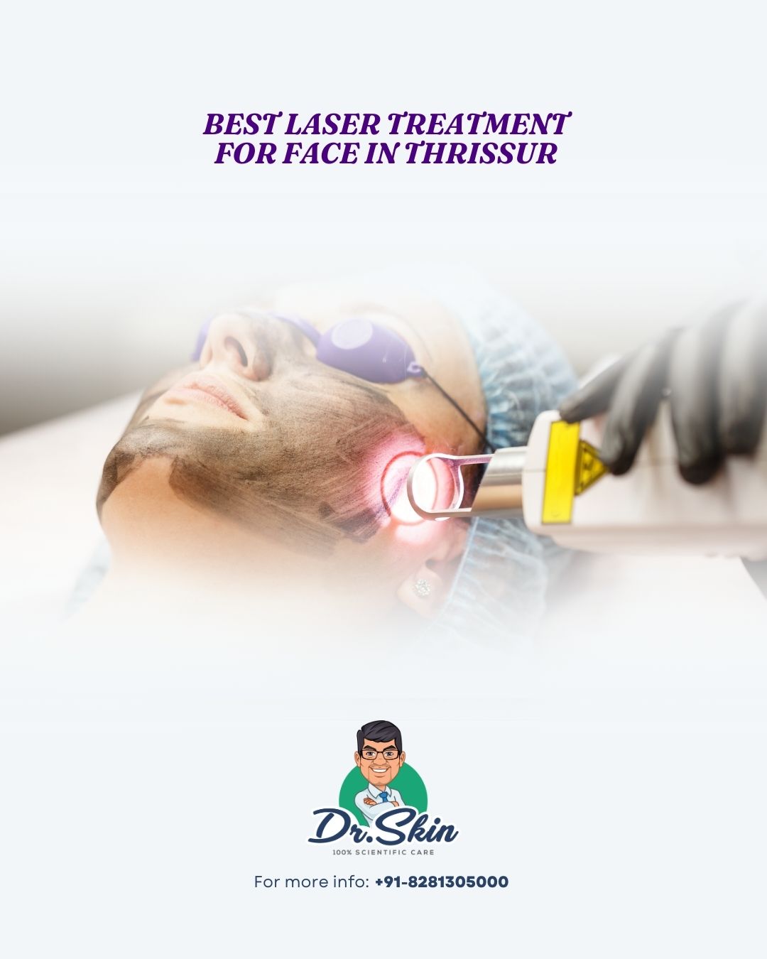 Best Laser Treatment for Face in Thrissur - Dr Skin